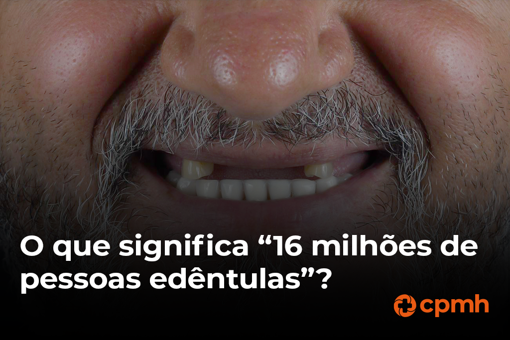 Edentulismo: 16 Milhões de Brasileiros Sem Dentes. | CPMH Digital
